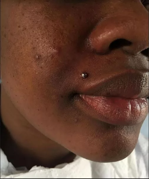 Monroe Piercing in Nairobi. Kenya - Rebel Inks Tattoos, Tattoo Removal ...